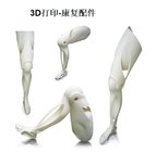 Customized Medical application artificial leg or waist 3D Printing Service With Competitive Price And Fast Delivery